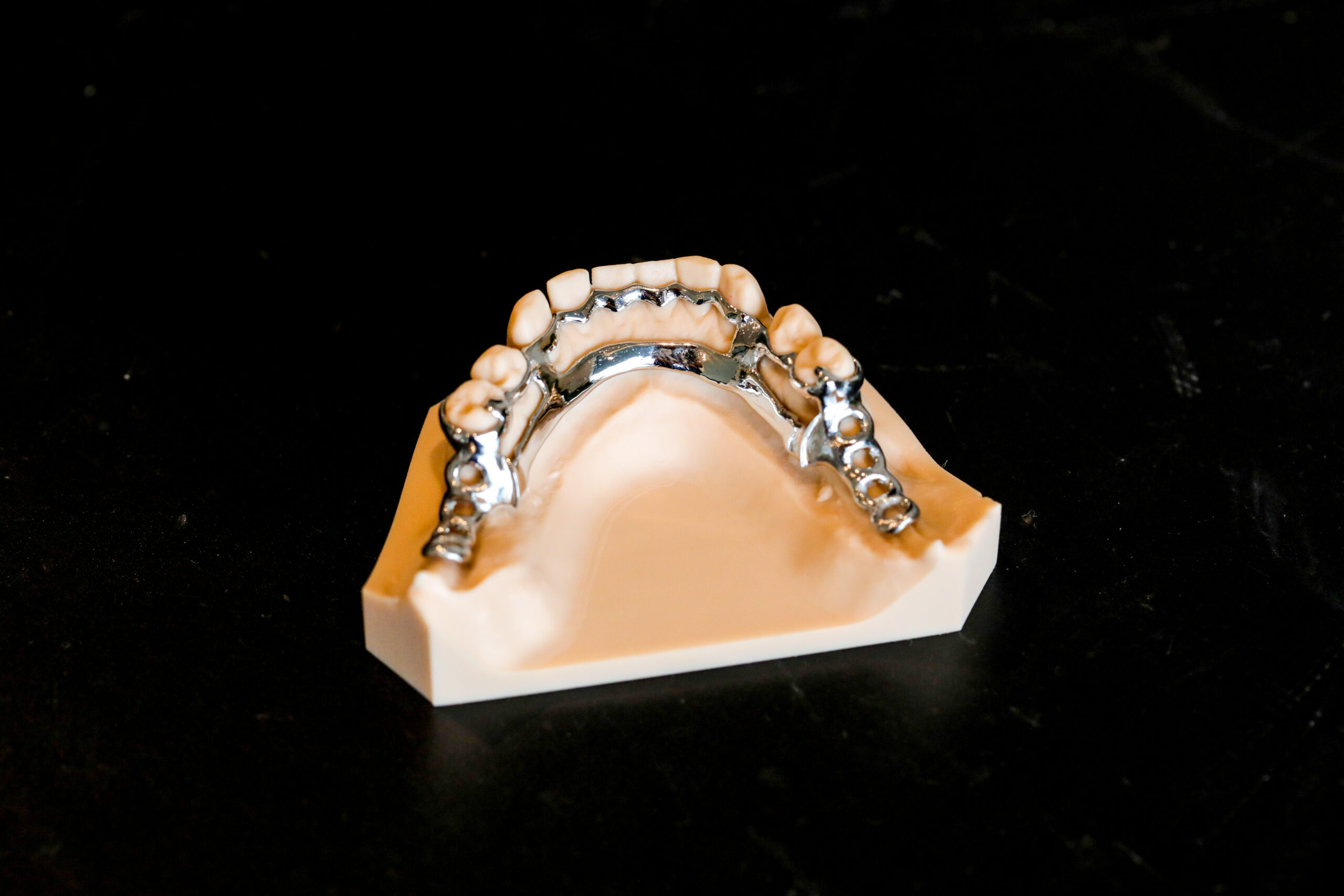 MJ Dentlab | TAD Appliances in dental appliances - MJ Dentlab in Sydney
